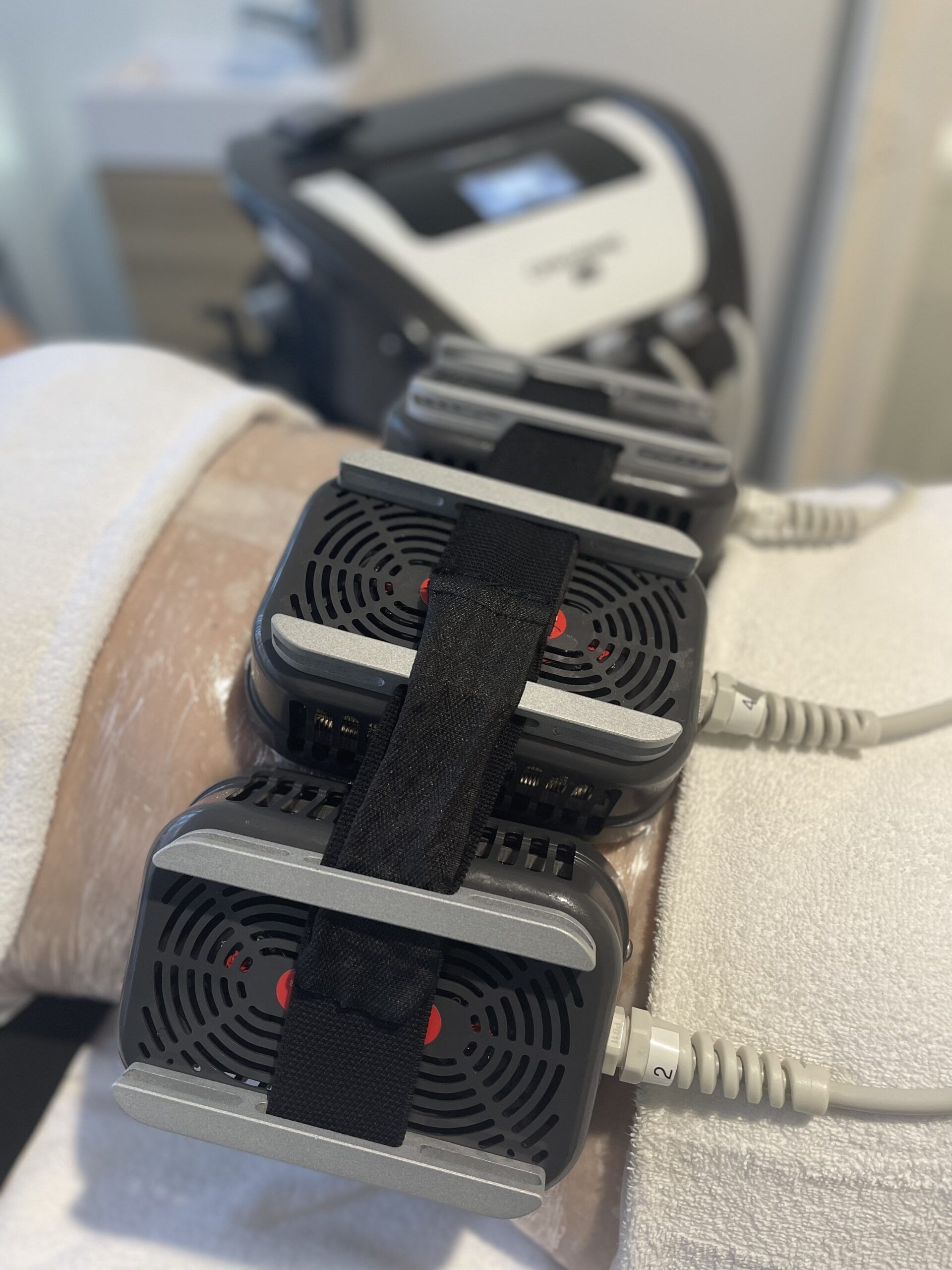 Fat Freezing Auckland - Azalea Therapy And SPA